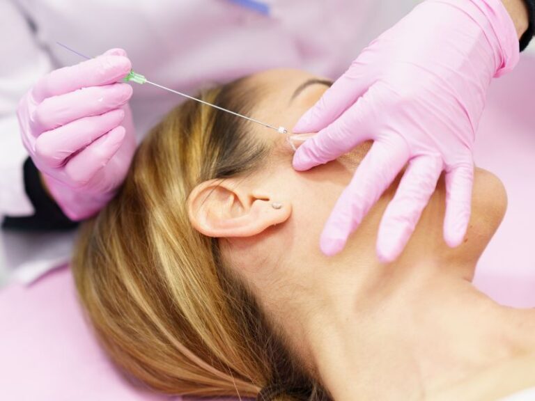 Thread Lift – Dr Amna's Clinic