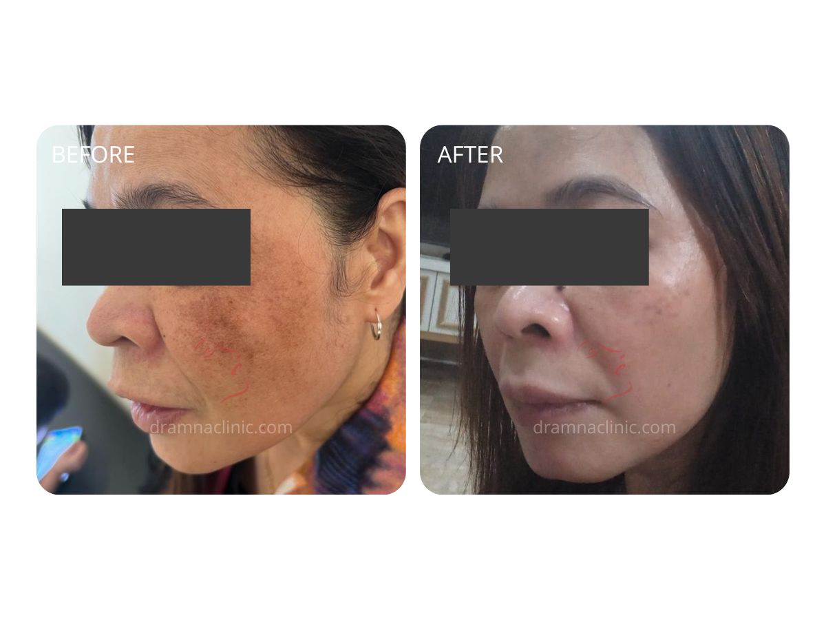 Skin Treatments – Dr Amna's Clinic